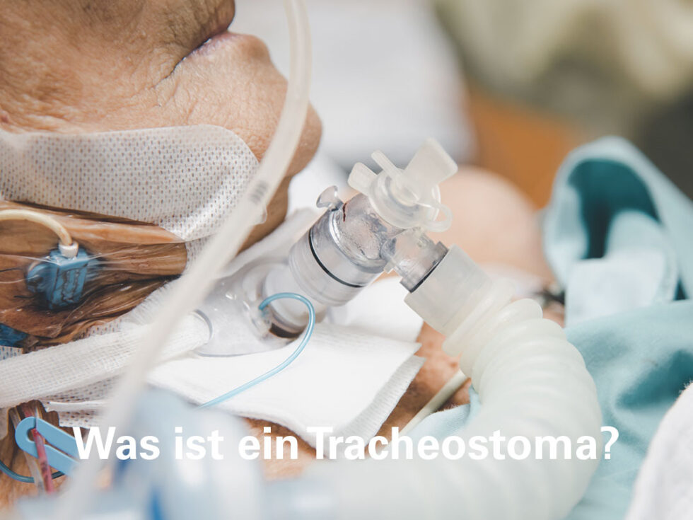 Was Ist Ein Tracheostoma? - VentiPro GmbH Pflegelexikon